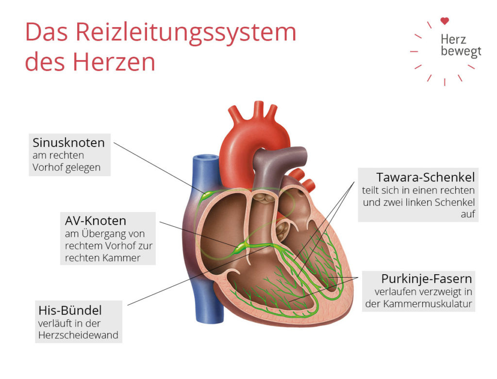 Leide ich an Vorhofflimmern? I Herz bewegt informiert