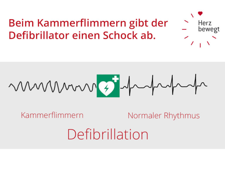 10 Antworten zum Thema Defibrillator - Herz bewegt